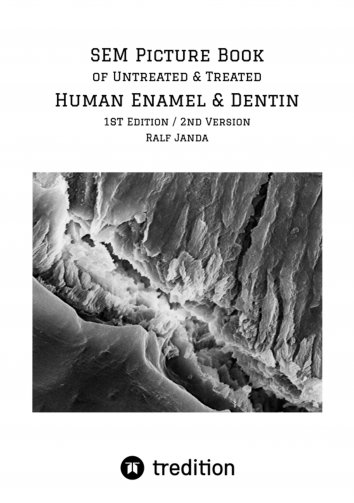 Ralf Janda - SEM Picture Book of Untreated & Treated Human Enamel ...